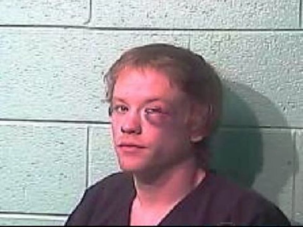 Kentucky Man Accused Of Pulling Victims Hair Driving Off